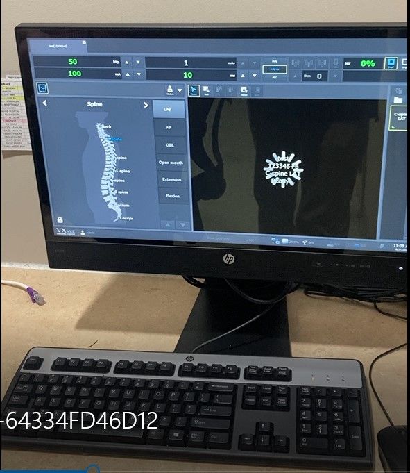 FXRD-1717SA DR Panel with Workstation
