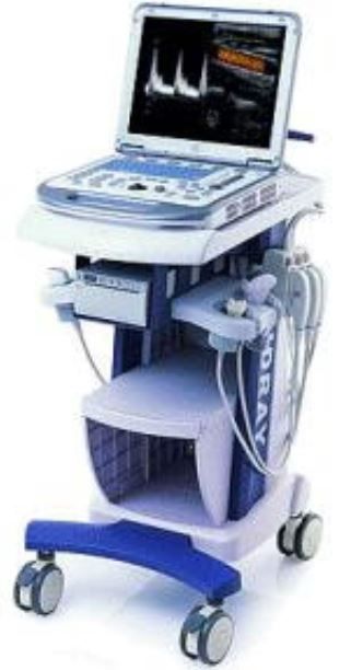 Mindray M5 Ultrasound