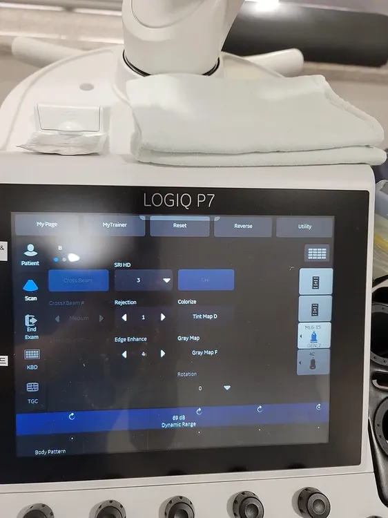 GE Logiq P7