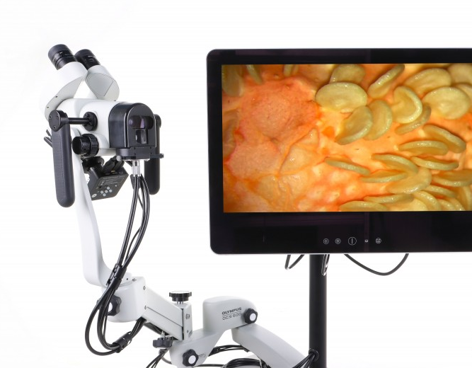 Olympus OCS-500 colposcope