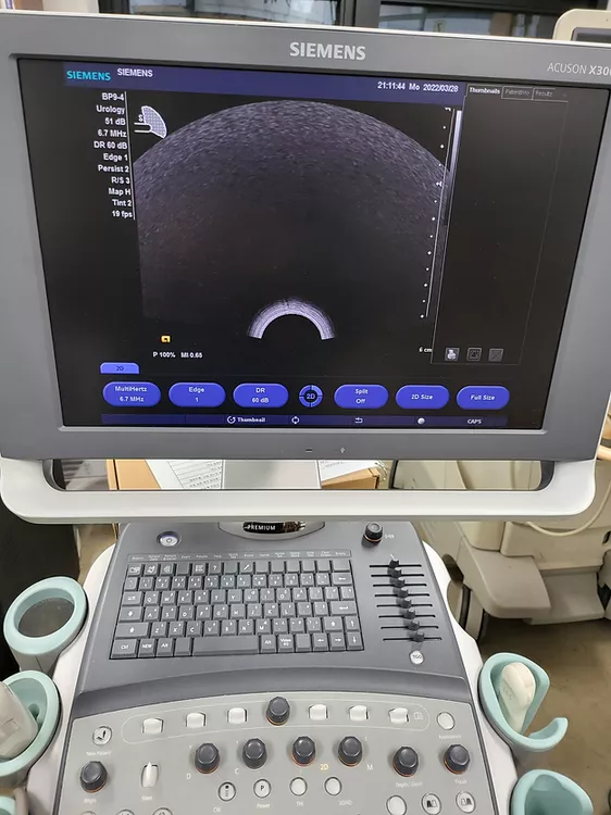 Siemens Acuson X300 Premium Edition Ultrasound System