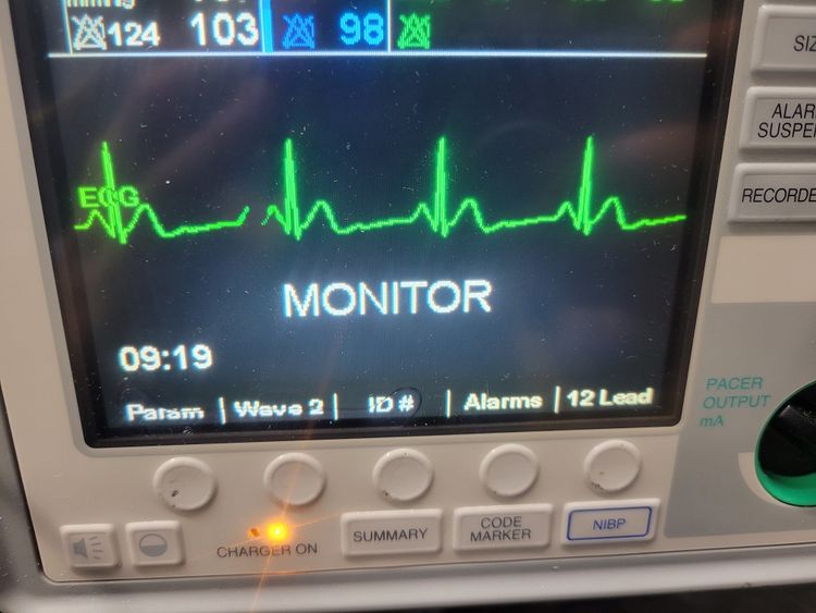 Zoll E Series Defibrillator Monitor with Pacing