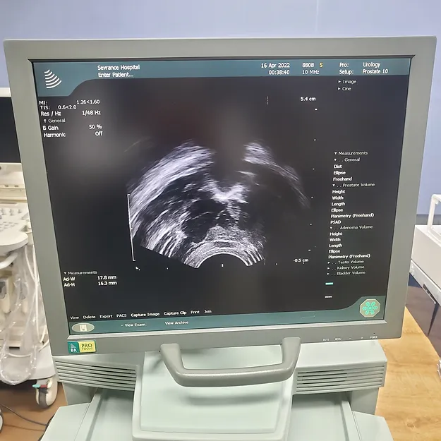 BK Medical Pro Focus 2202