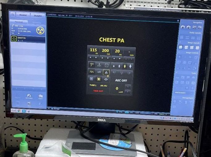 Dr Rayence Wireless 1417WCA